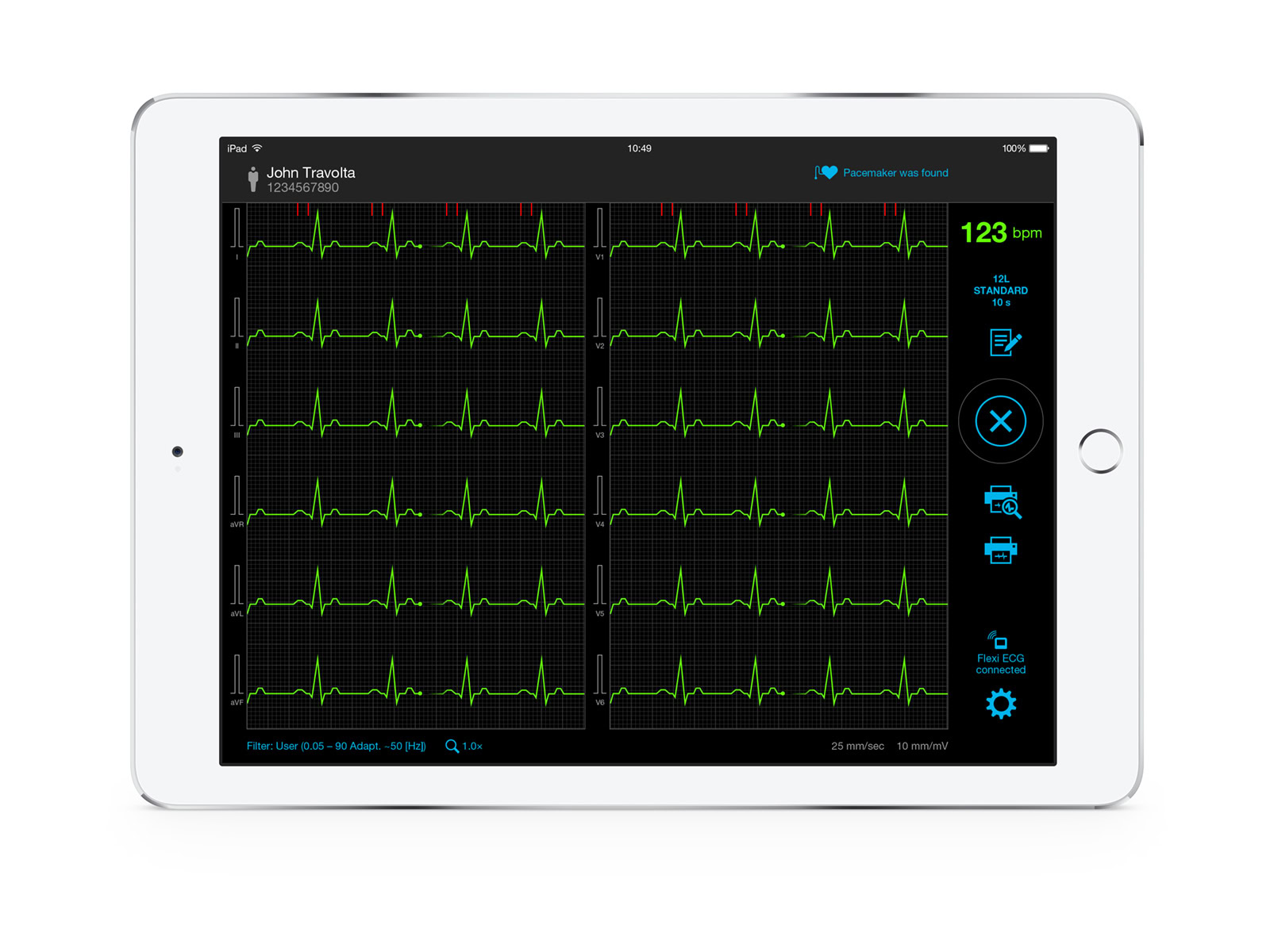 Cardio­Point – iPad – GUI | Divan Design